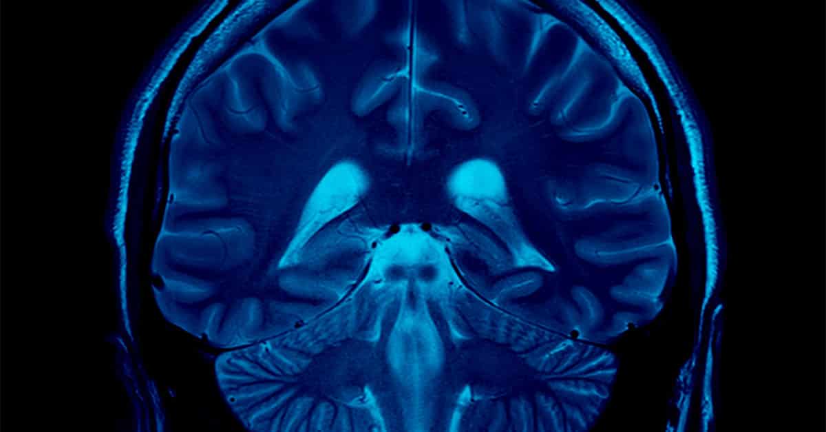 Wide Bore MRI Scan Services Melbourne | Melbourne Radiology Wide Bore MRI Scan Services Melbourne | Melbourne Radiology